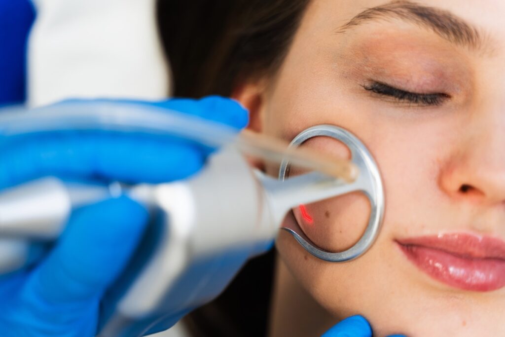 Laser Treatments Treatment in Orlando, FL | Knight Dermatology